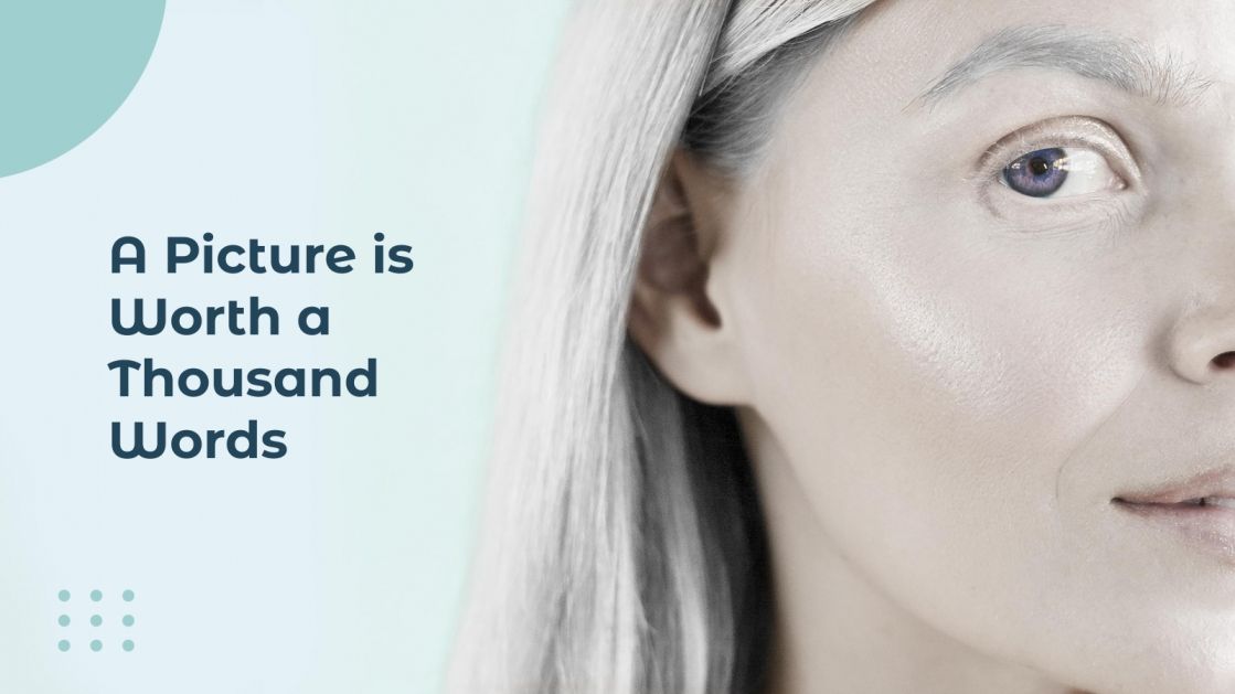 Albinism Clinical Case Google Slides & PowerPoint template