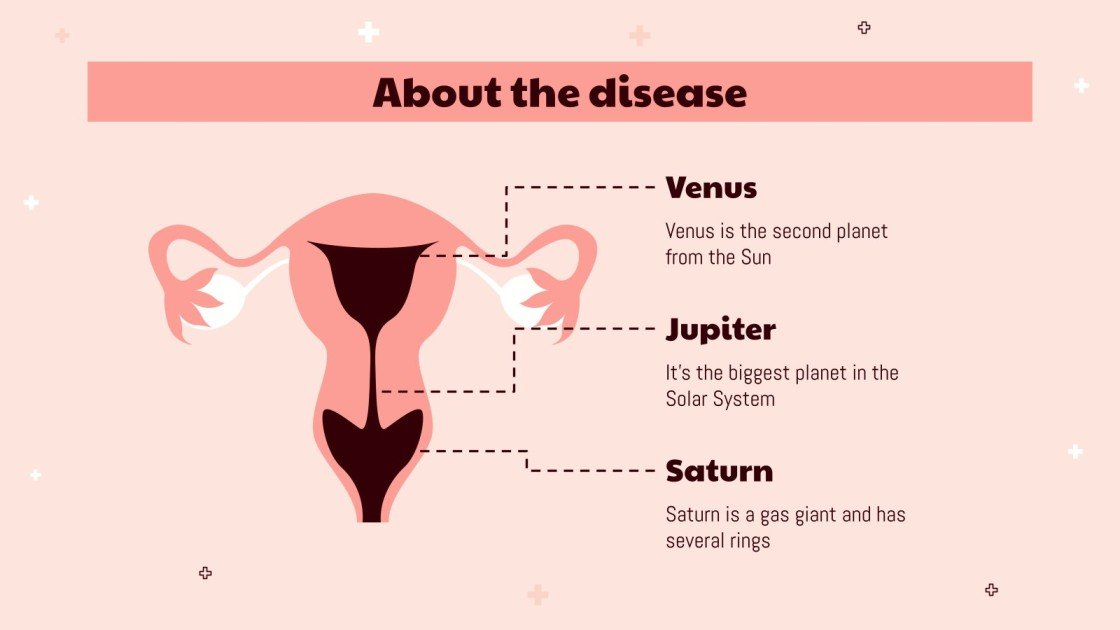 Uterus Fibroids Disease | Google Slides and PowerPoint