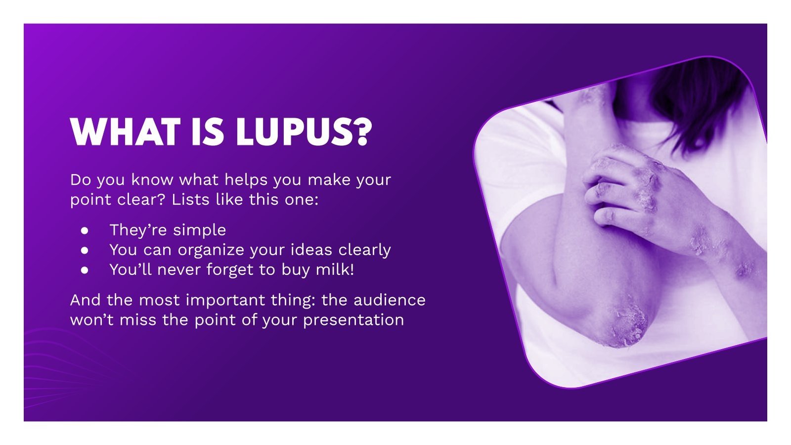 May is Lupus Awareness Month! | Google Slides & PowerPoint