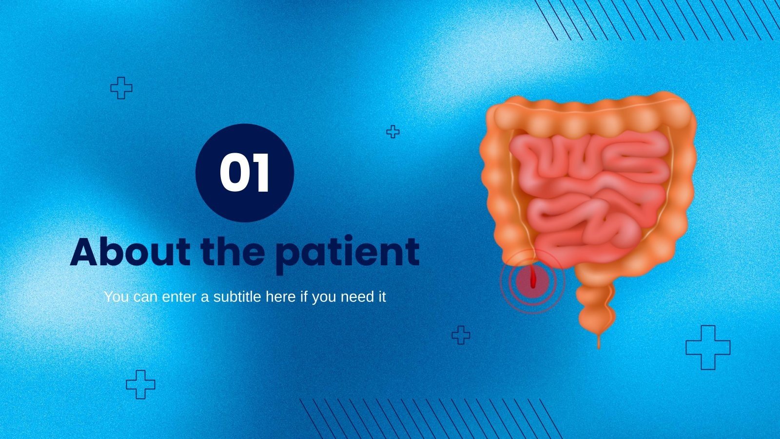 Acute Appendicitis Clinical Case | Google Slides & PPT