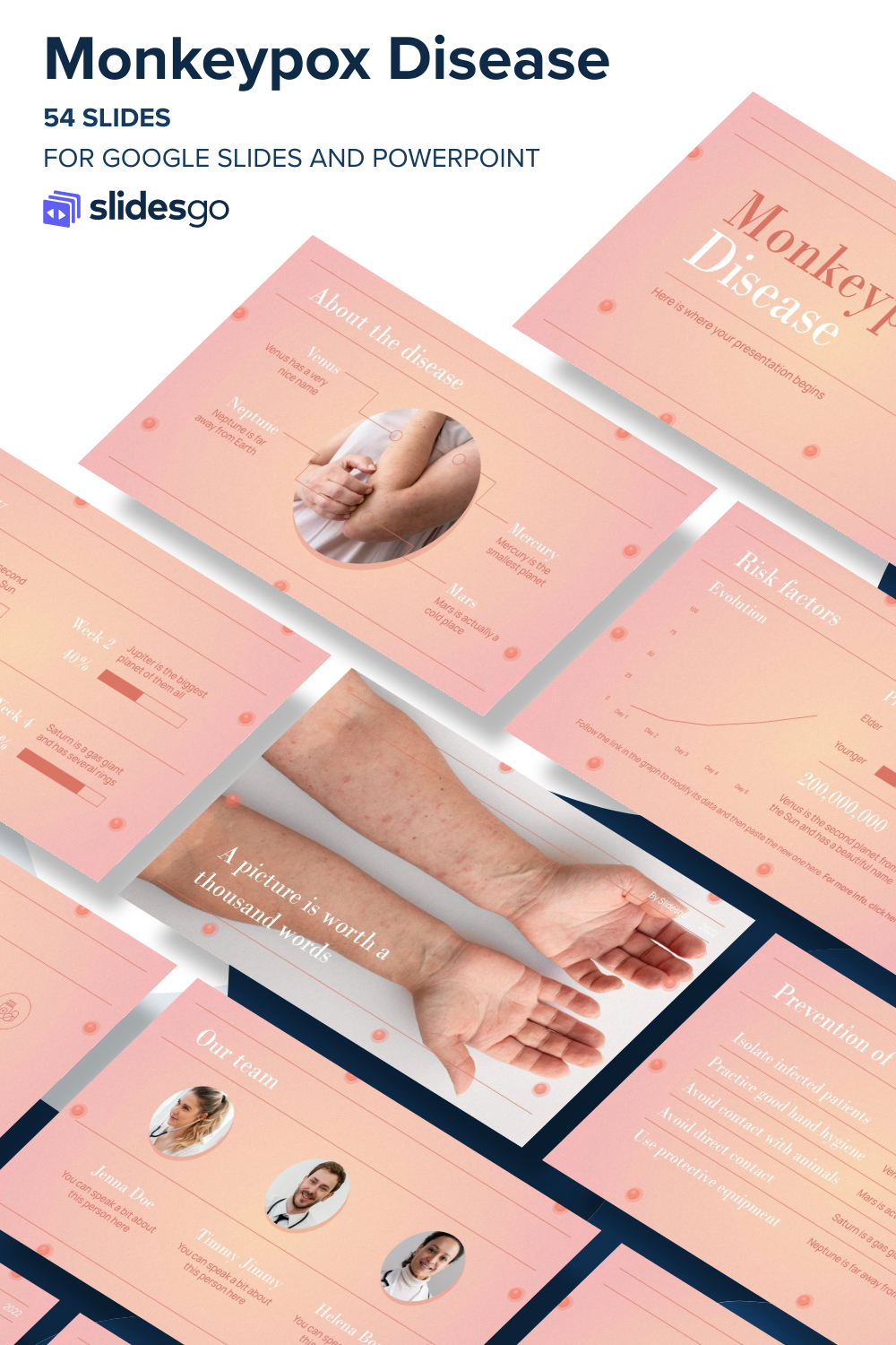 Monkeypox Disease | Google Slides & PowerPoint