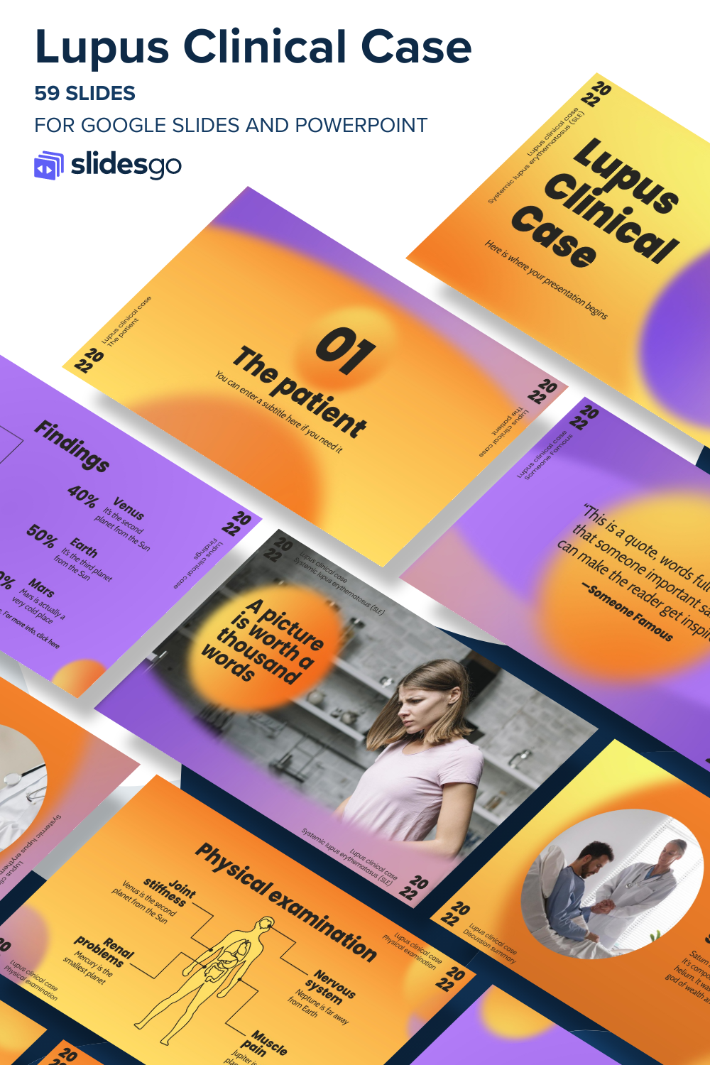 Lupus Clinical Case | Google Slides & PowerPoint template