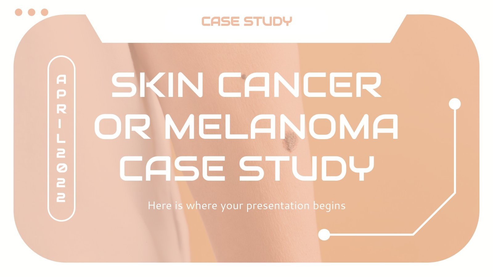 Skin Cancer or Melanoma Case Study | Google Slides & PPT