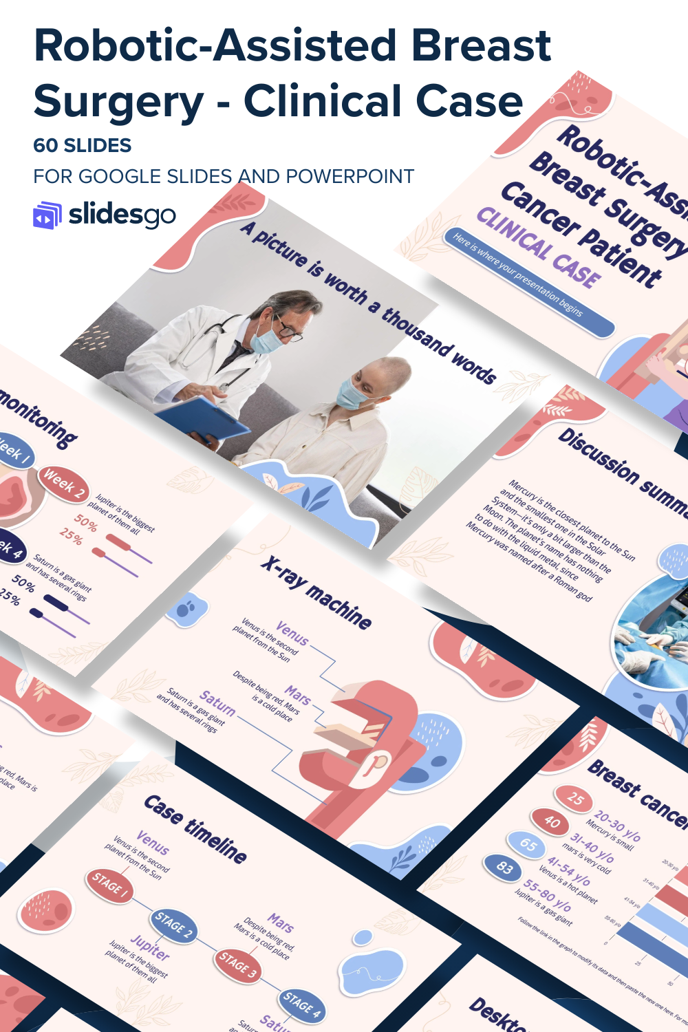 Robotic-Assisted Breast Cancer Surgery - Clinical Case