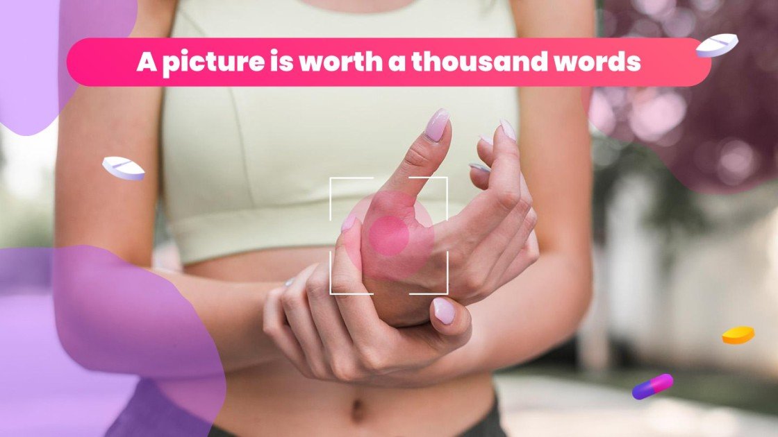 All About Arthritis | Google Slides and PowerPoint