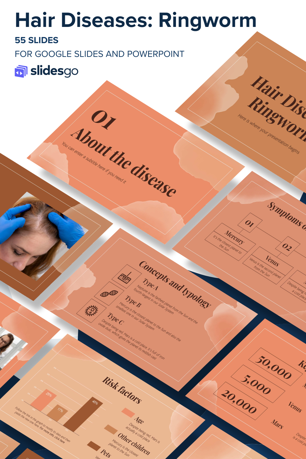 Hair Diseases: Ringworm | Google Slides & PowerPoint