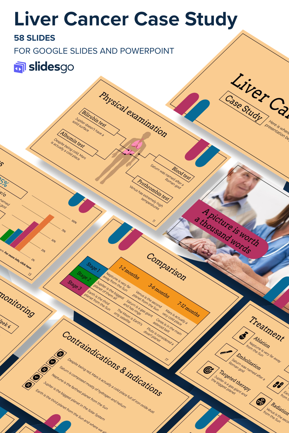 Liver Cancer Case Study | Google Slides & PowerPoint