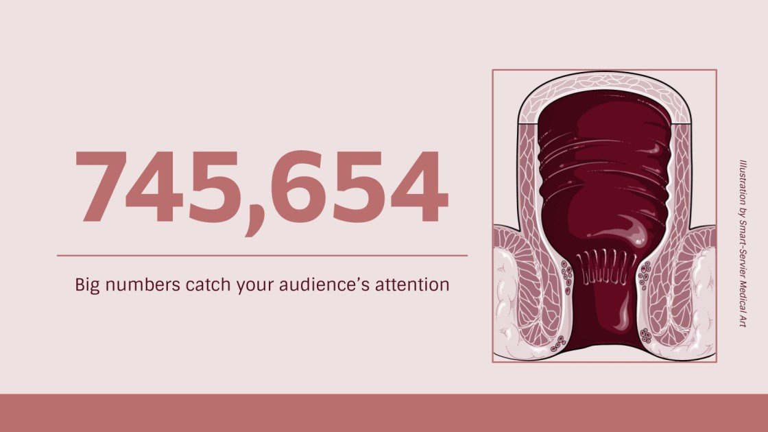 Digestive Problems: Hemorrhoids | Google Slides & PowerPoint