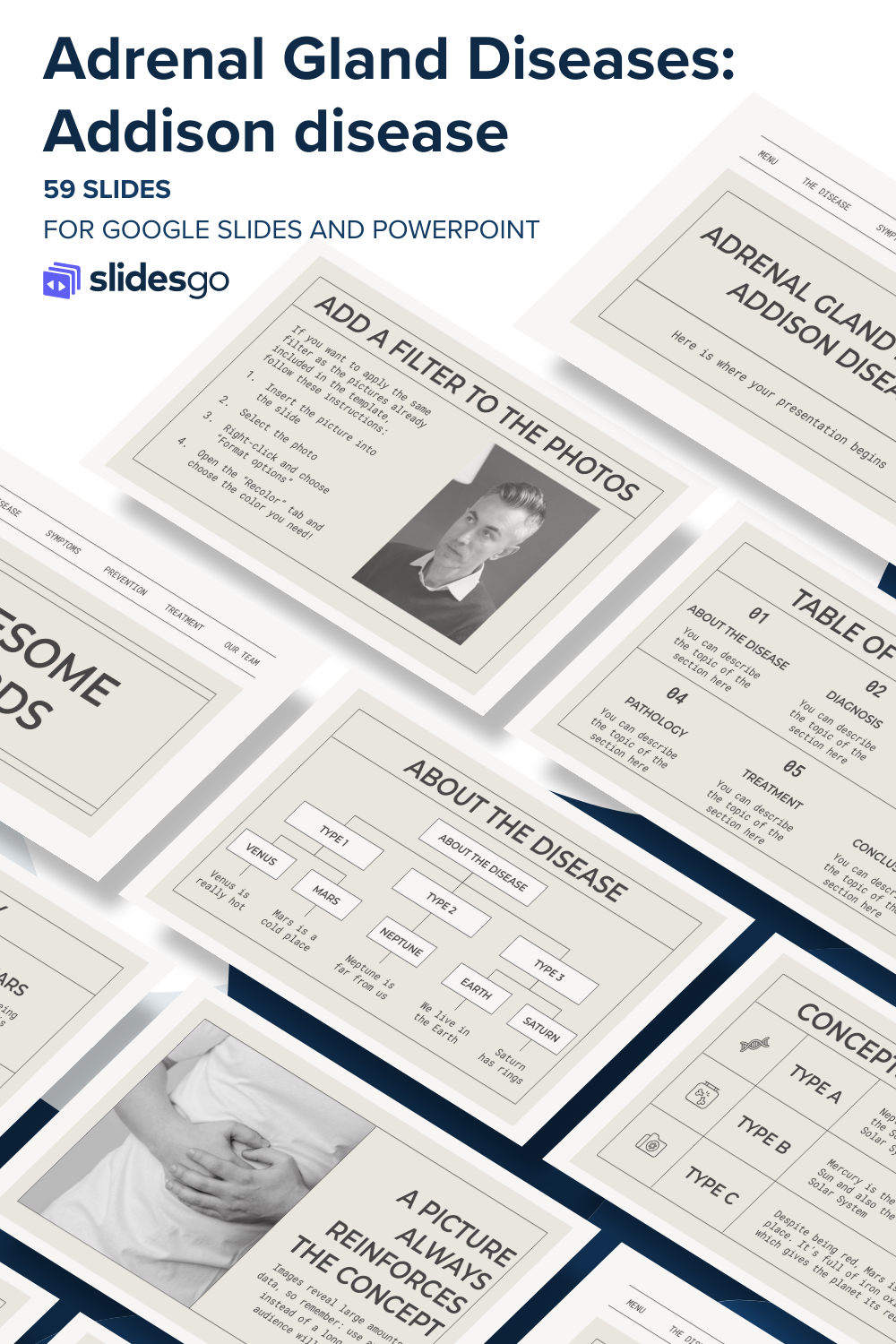 Adrenal Gland Diseases: Addison disease | Google Slides