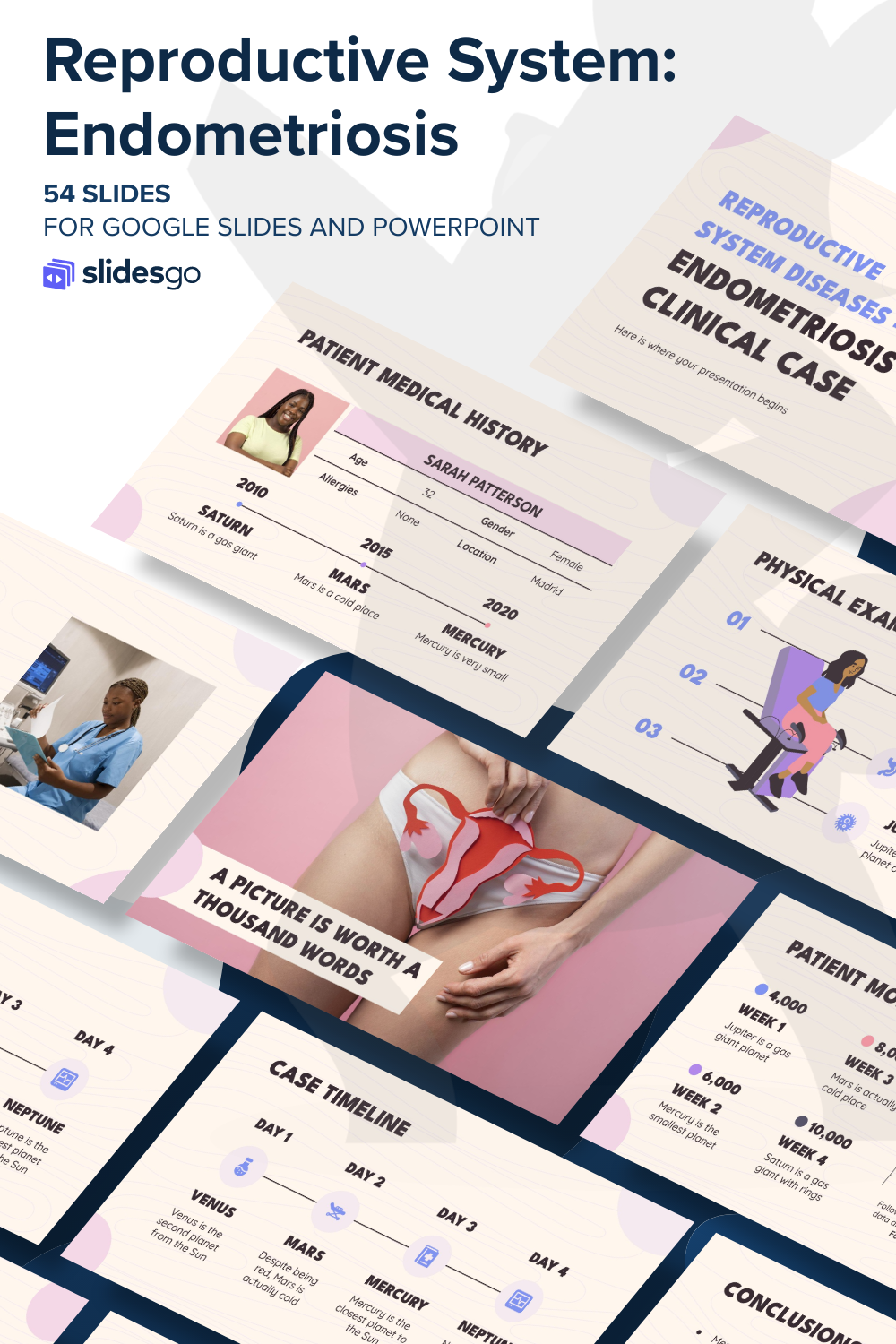 Reproductive System Diseases - Endometriosis Clinical Case