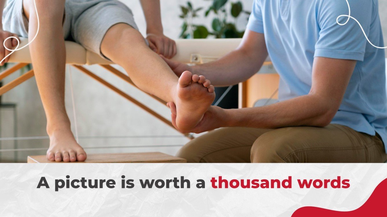 Skin Diseases: Athlete's Foot Case Report | Google Slides