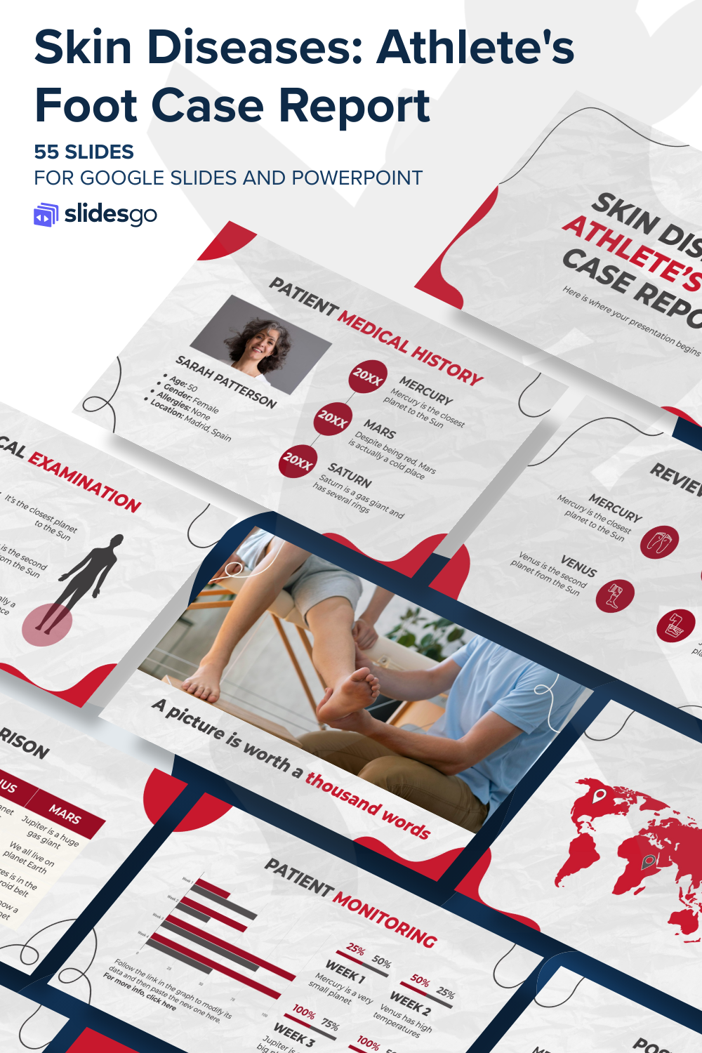 Skin Diseases: Athlete's Foot Case Report | Google Slides