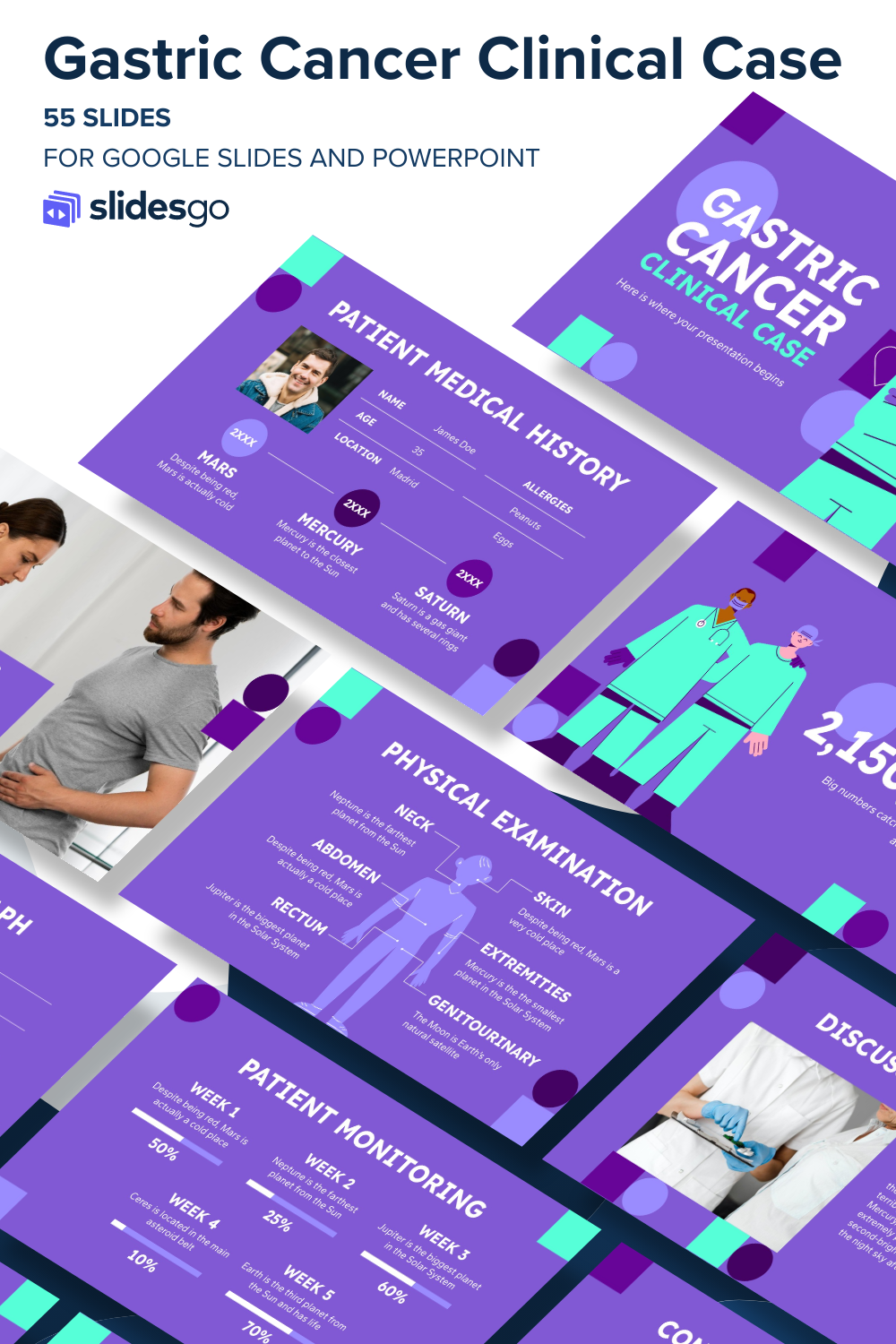 Gastric Cancer Clinical Case | Google Slides & PowerPoint