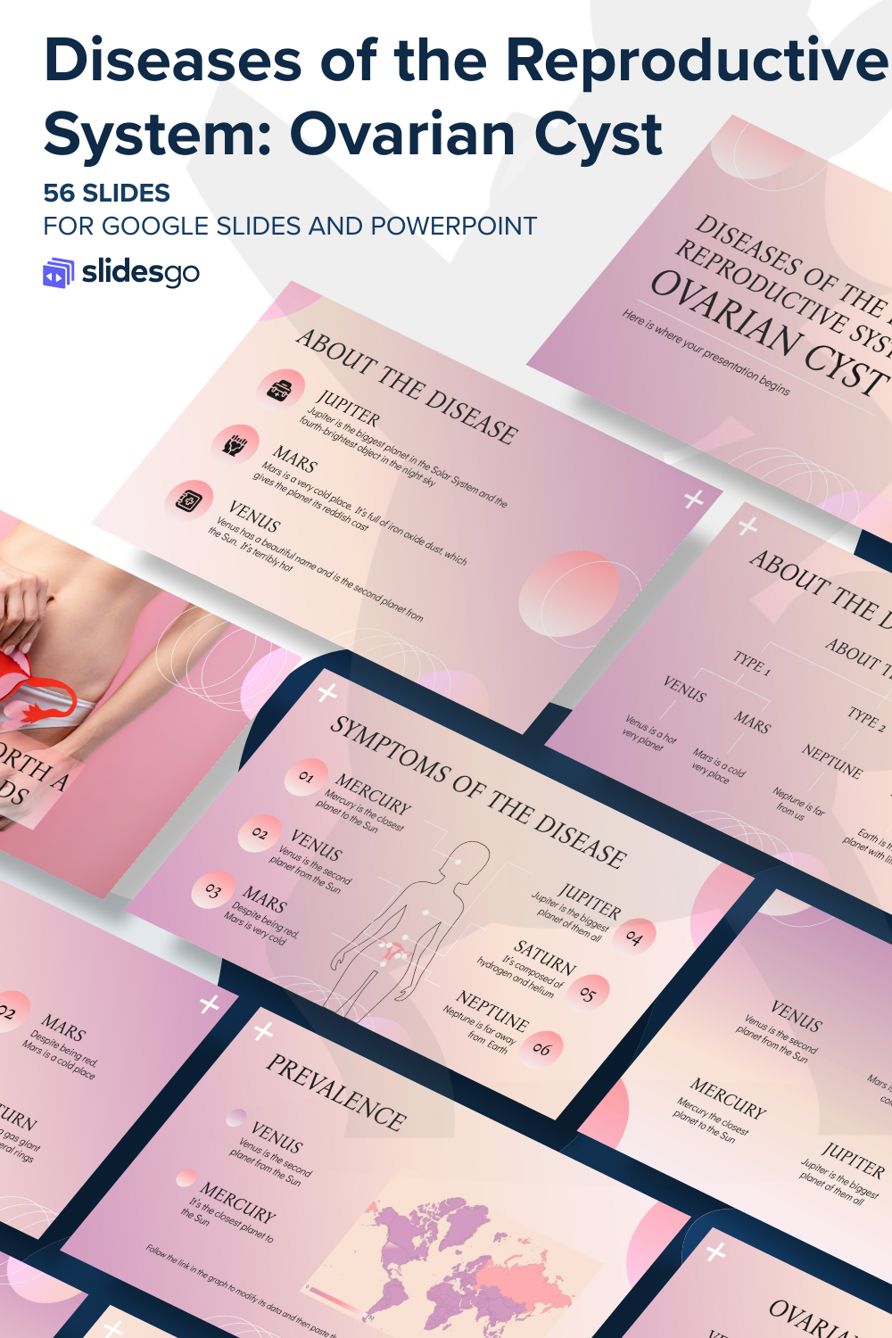 Diseases of the Female Reproductive System: Ovarian Cyst