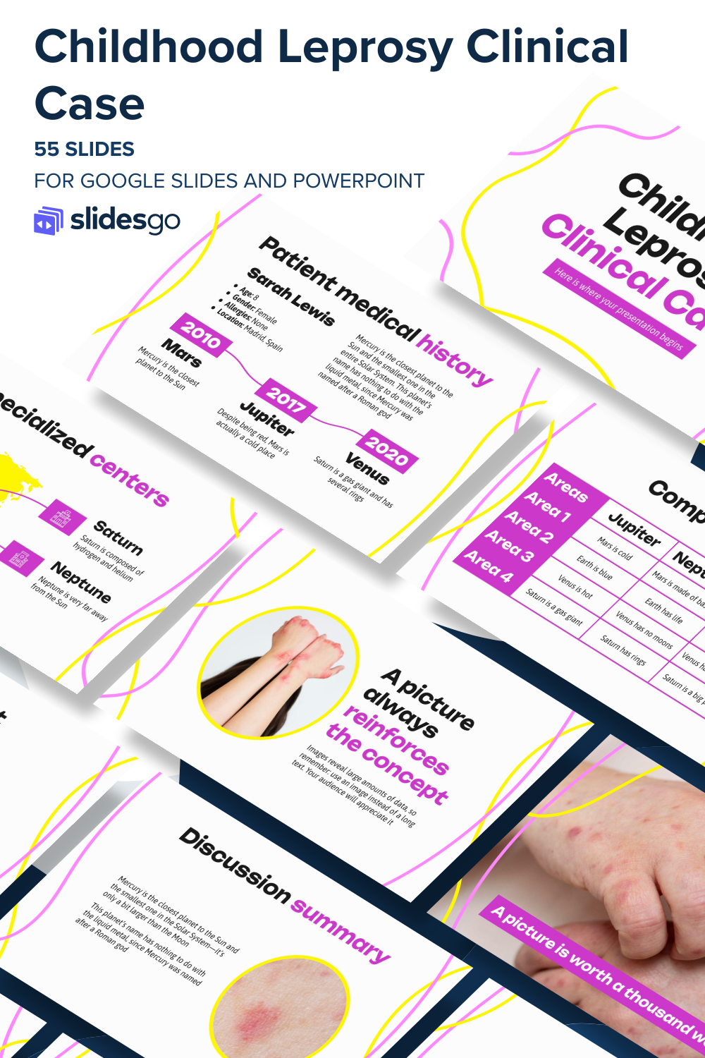 Childhood Leprosy Clinical Case | Google Slides & PPT