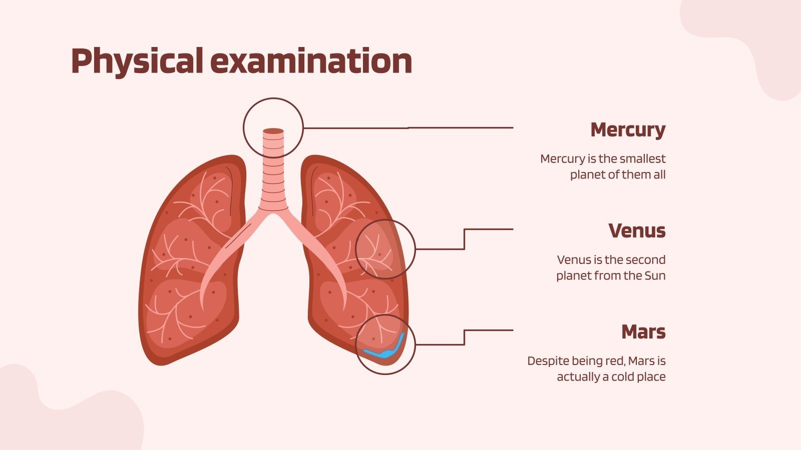 Malignant Pleural Effusion Case Report | Google Slides & PPT