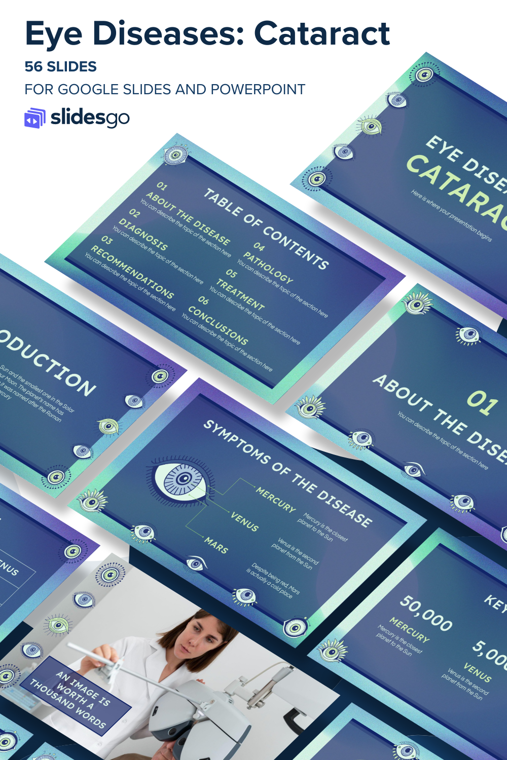 Eye Diseases: Cataract | Google Slides & PowerPoint