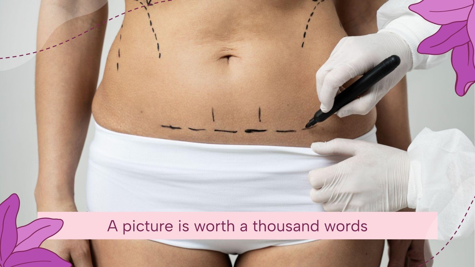 Abdomen Surgery Center | Google Slides & PowerPoint