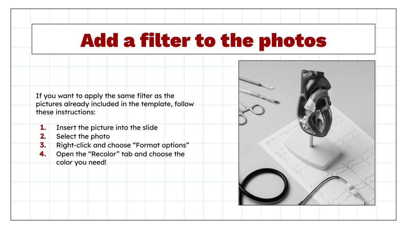 How to Read an Electrocardiogram (EKG) | Google Slides