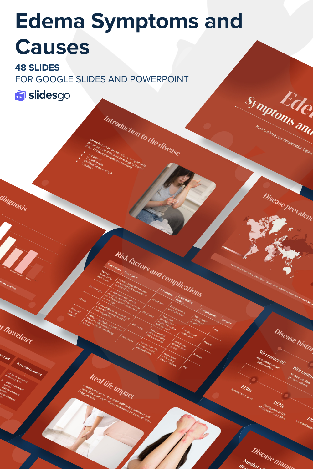 Edema Symptoms and Causes | Google Slides & PowerPoint