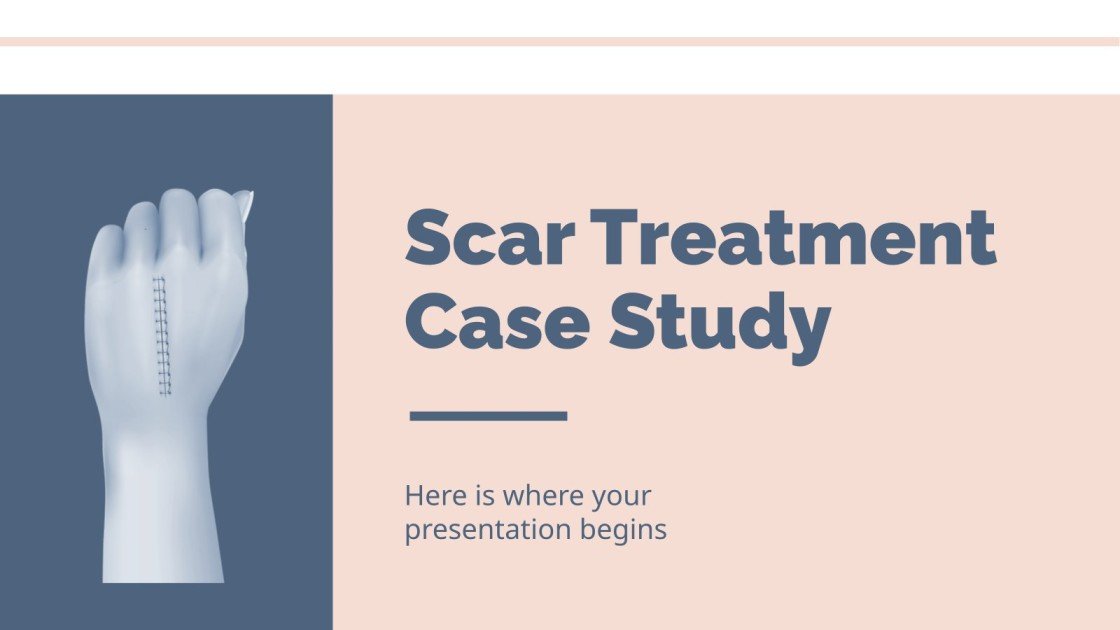 Scar Treatment Case Study | Google Slides & PowerPoint