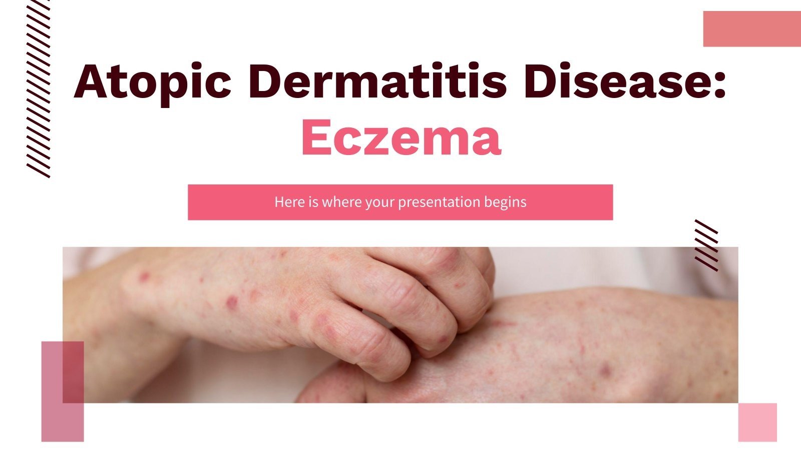 Dermatite atopique : Eczéma | Google Slides et PPT
