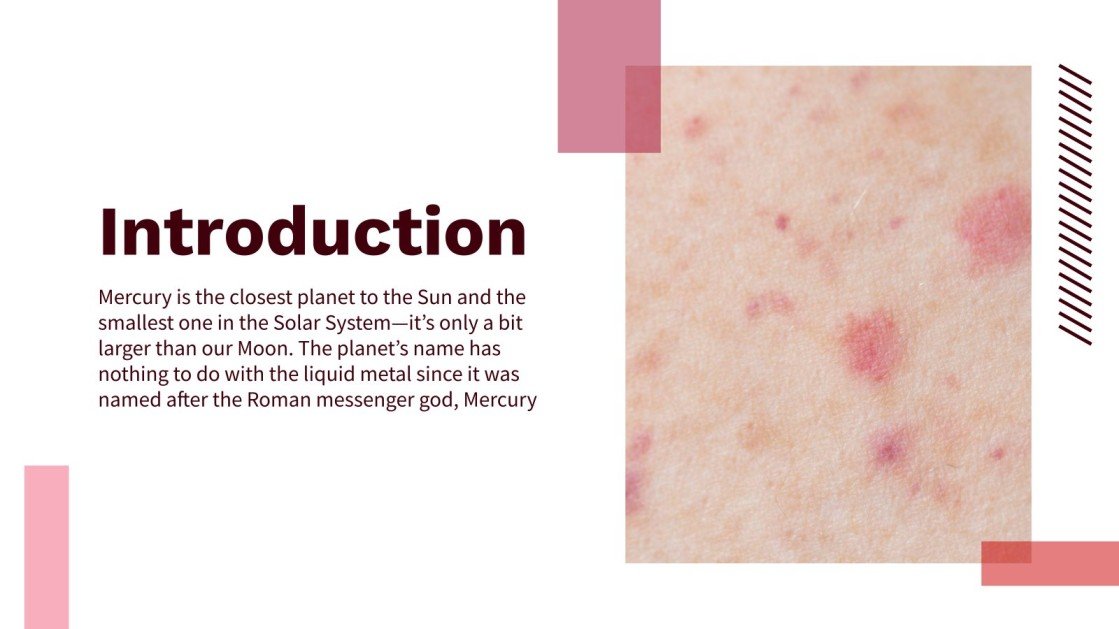 Dermatite atópica: eczema | Google Slides e PowerPoint