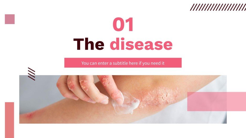 Dermatite atopique : Eczéma | Google Slides et PPT