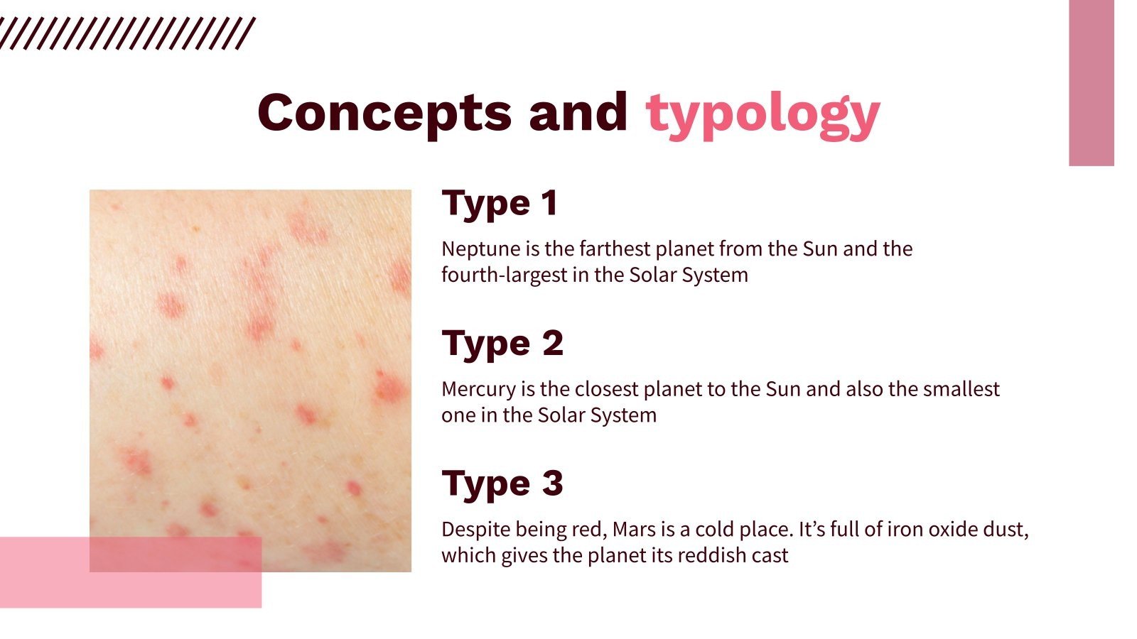 Atopic Dermatitis Disease: Eczema | Google Slides & PPT