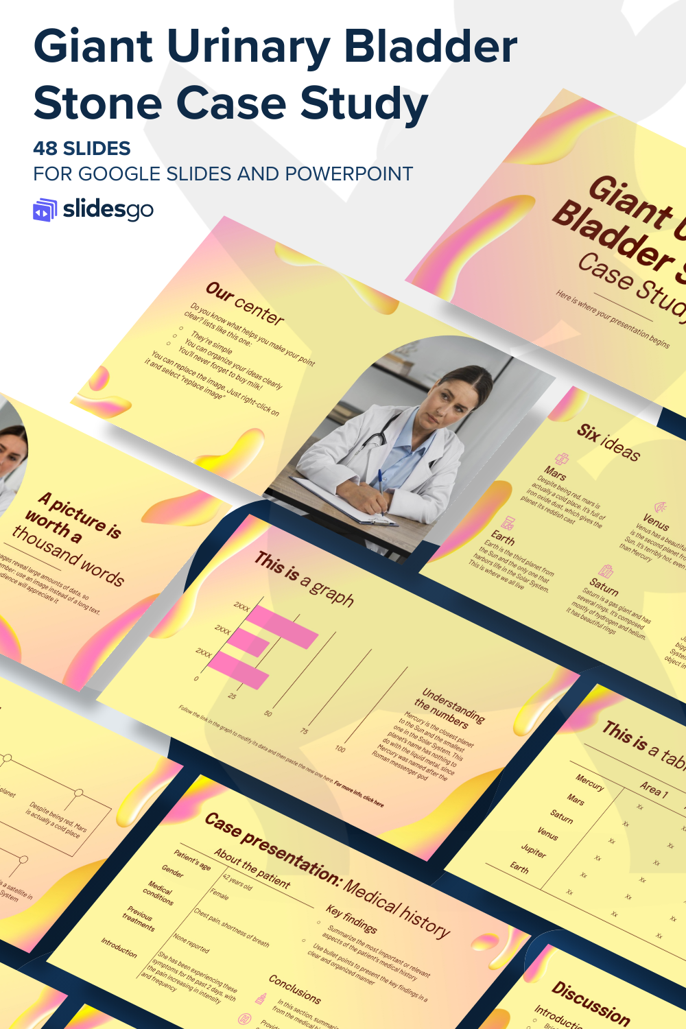 Giant Urinary Bladder Stone Case Study | Google Slides & PPT