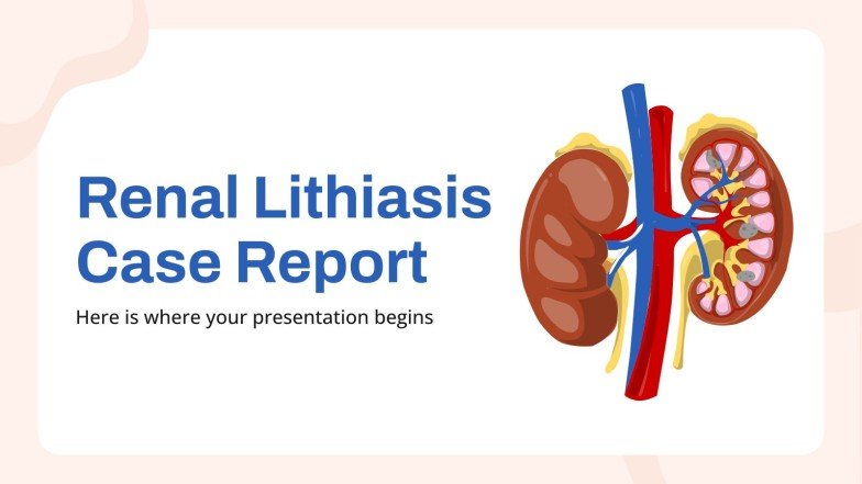 Renal Lithiasis Case Report | Google Slides & PPT