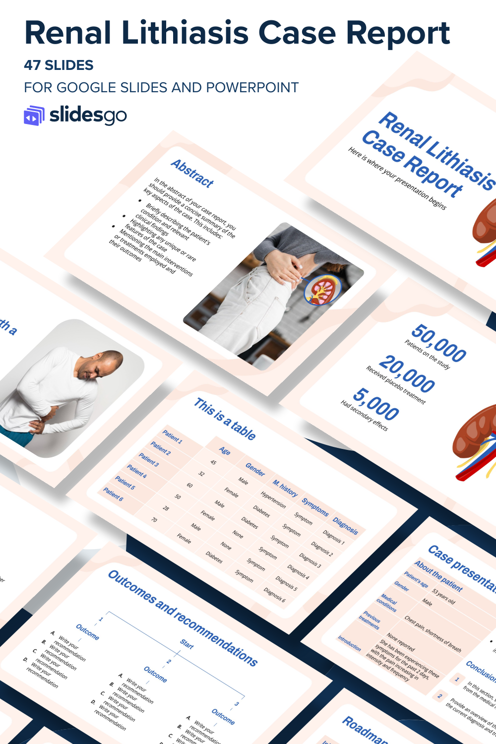 Renal Lithiasis Case Report | Google Slides & PPT