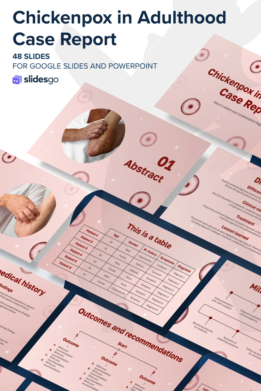Chickenpox in Adulthood Case Report | Google Slides & PPT