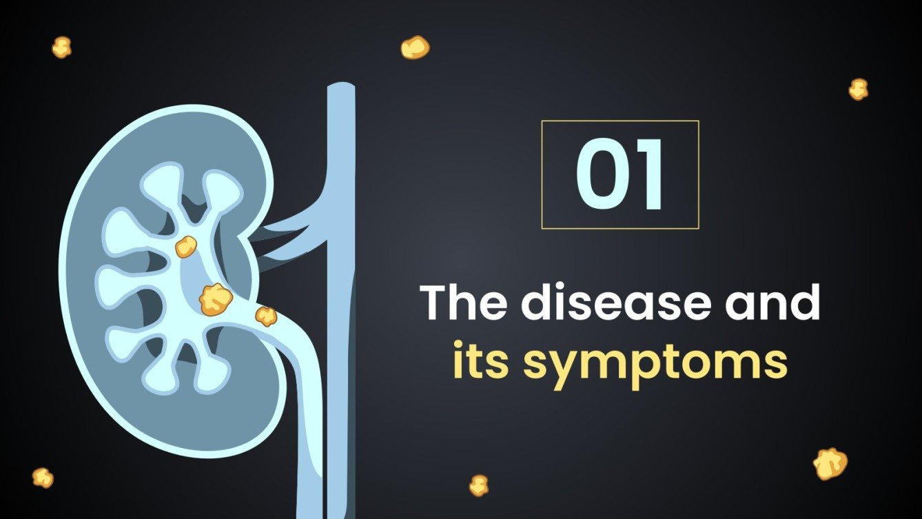 Renal Lithiasis Disease | Google Slides & PowerPoint