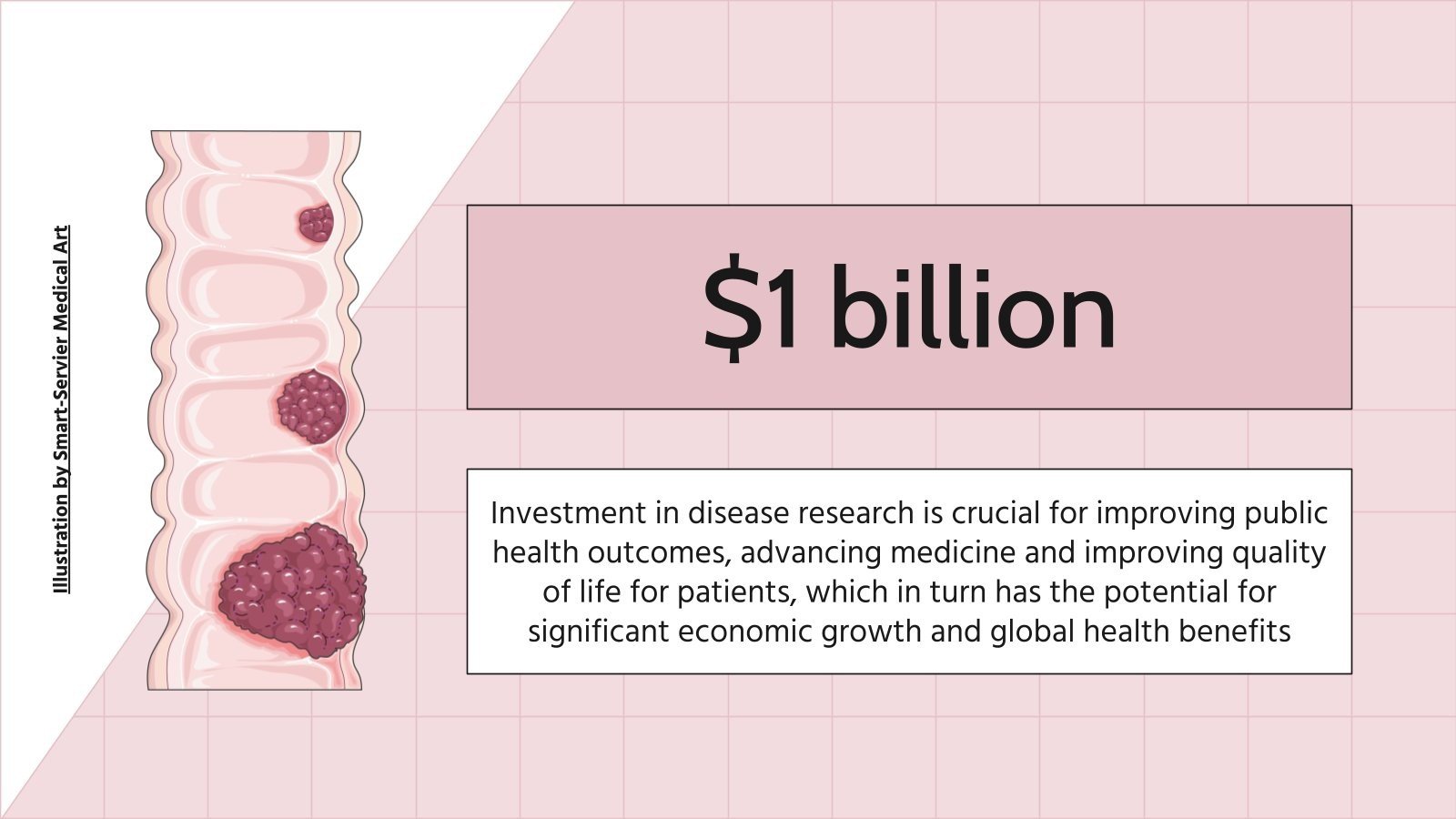 Large Intestine Diseases | Google Slides & PPT