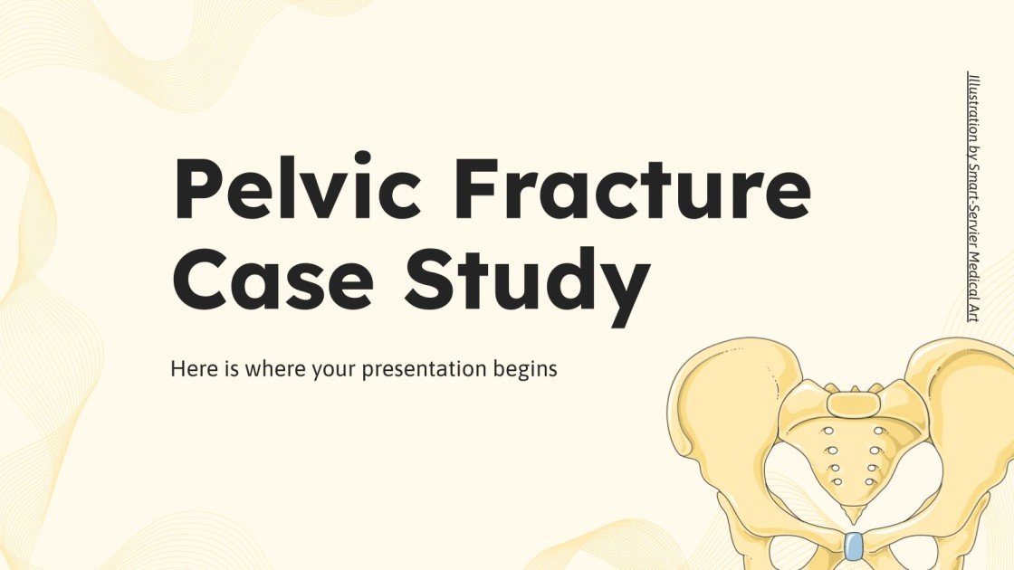 Free Case Report Google Slides and PowerPoint templates