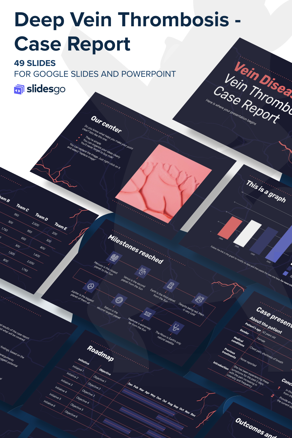 Vein Diseases: Deep Vein Thrombosis - Case Report