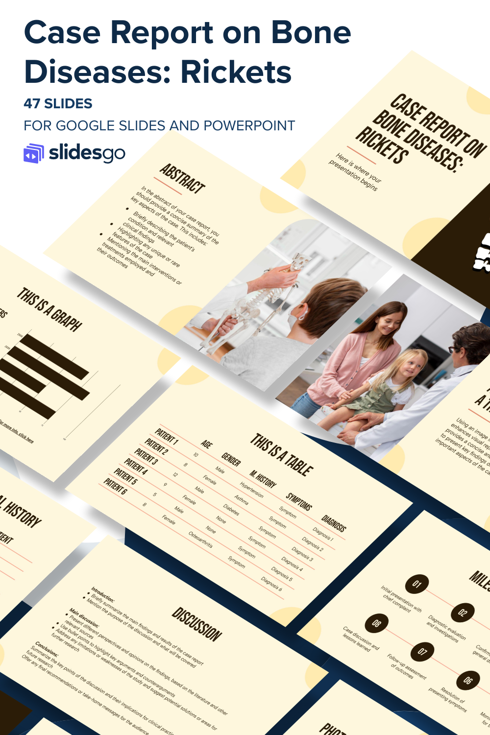 Case Report on Bone Diseases: Rickets