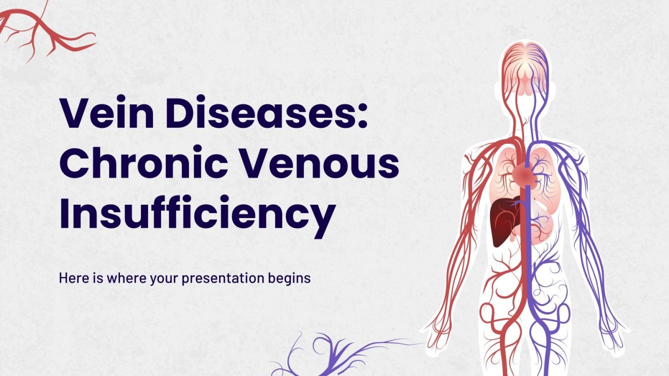Vein Diseases: Chronic Venous Insufficiency | Google Slides