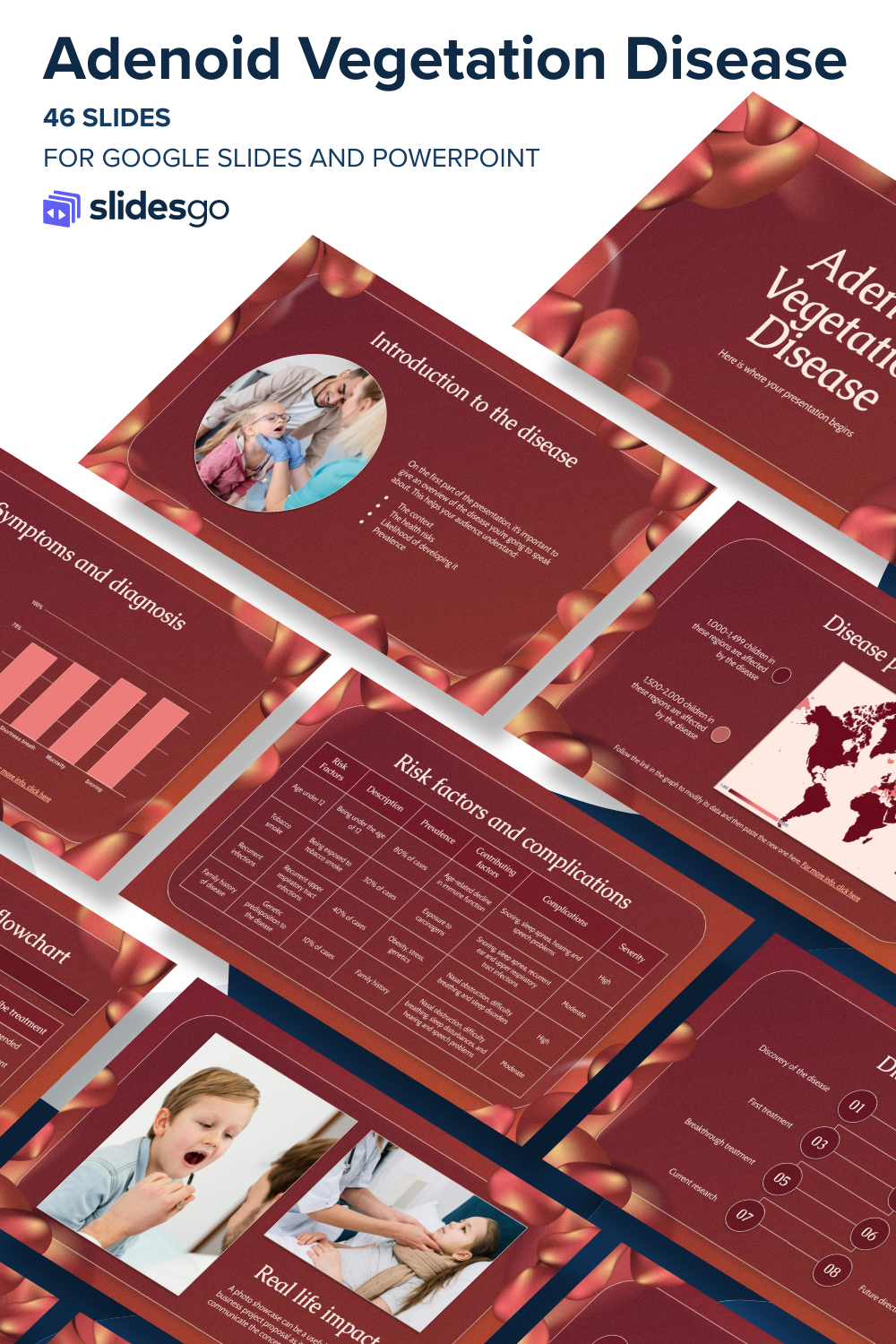 Adenoid Vegetation Disease | Google Slides & PPT