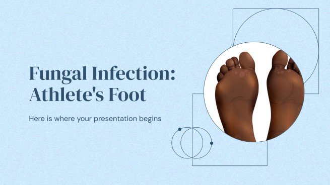 Fungal Infection: Athlete's Foot | Google Slides & PPT