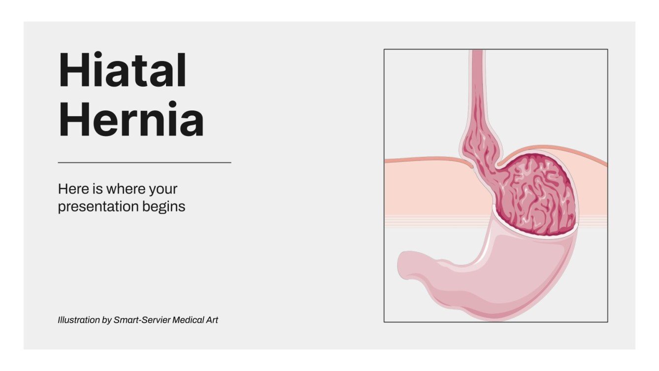 Hiatal Hernia | Google Slides & PowerPoint template