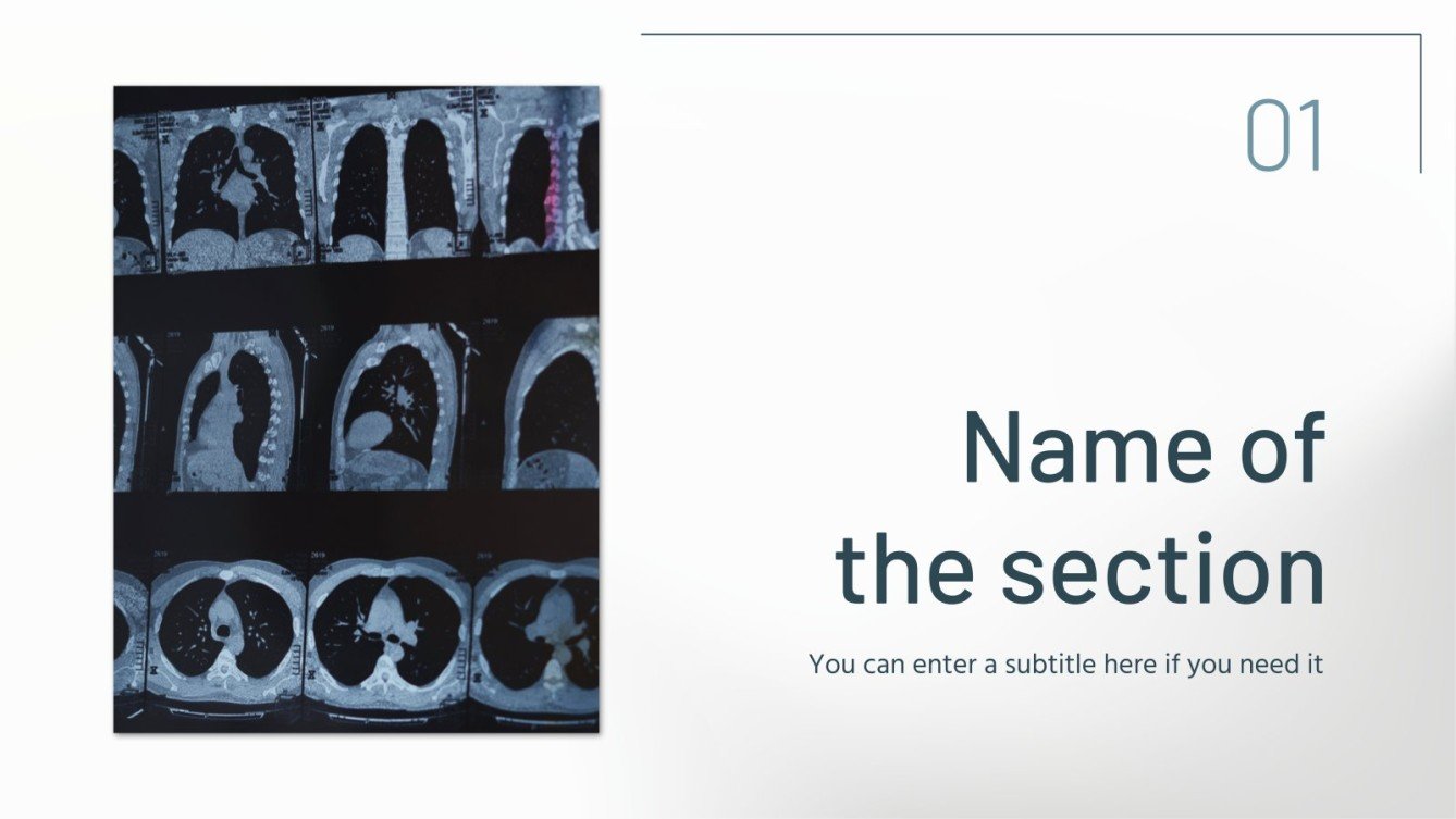 All About Radiology | Google Slides & PowerPoint template