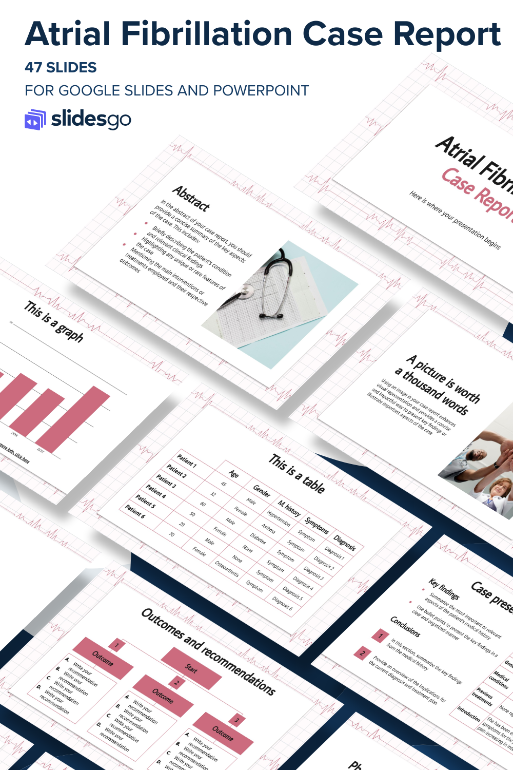 Atrial Fibrillation Case Report Presentation