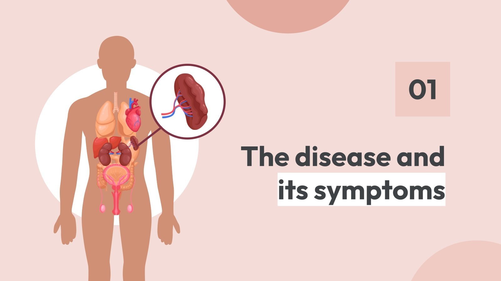 Spleen Inflammation: Splenomegaly Presentation