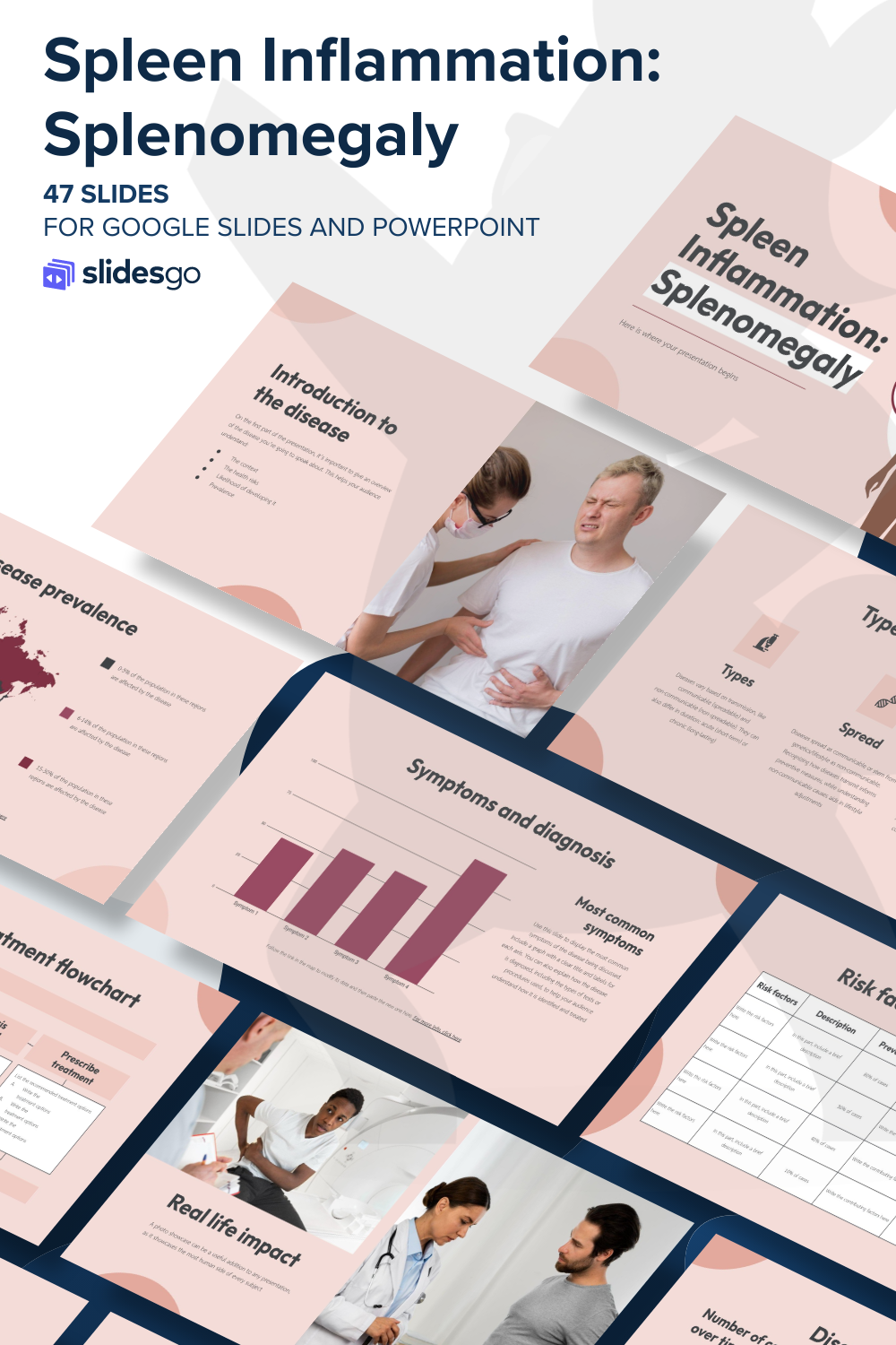 Spleen Inflammation: Splenomegaly Presentation
