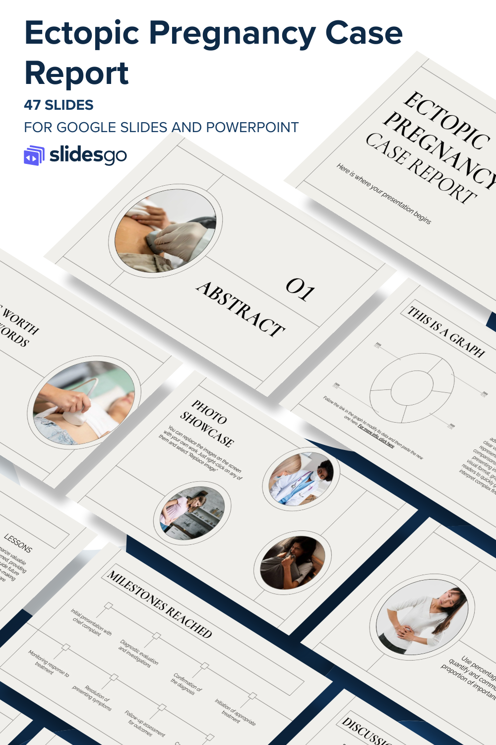 Ectopic Pregnancy Case Report Presentation