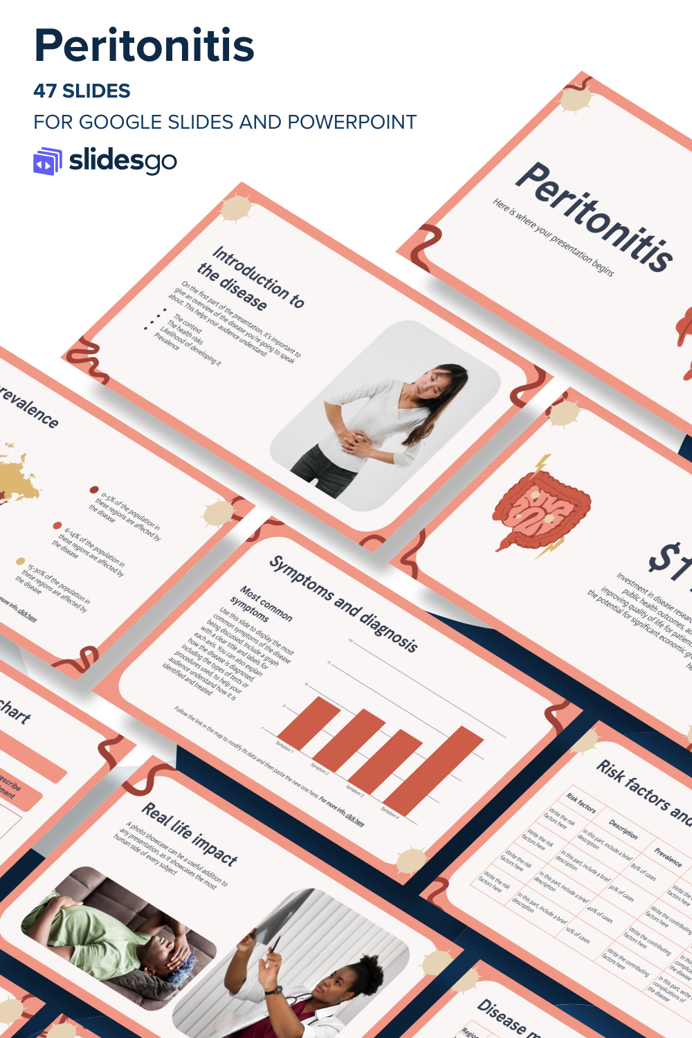 Peritonitis Presentation