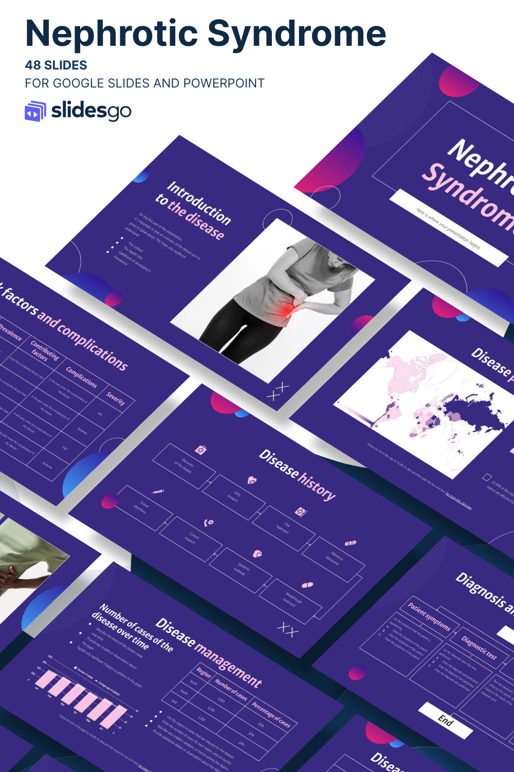 Nephrotic Syndrome Presentation