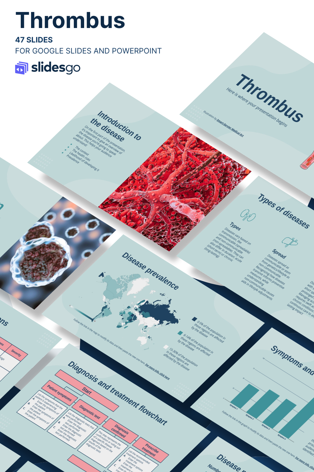 Thrombus Presentation